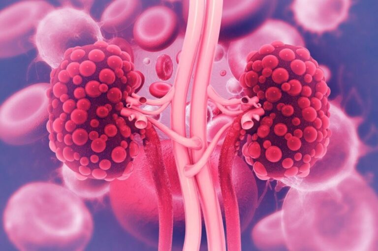 25 Kidney-Friendly Foods to Improve Your Overall Health - Nephro Arabia